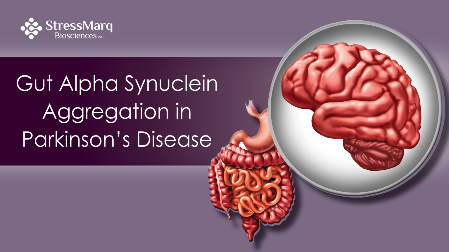 Gut Alpha Synuclein Aggregation in Parkinson’s Disease