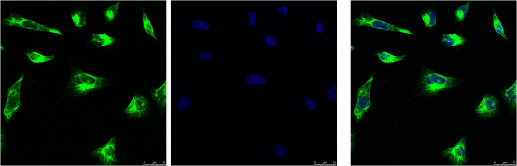 Vimentin Antibodies for Immunofluorescence - Antibody Resource Page