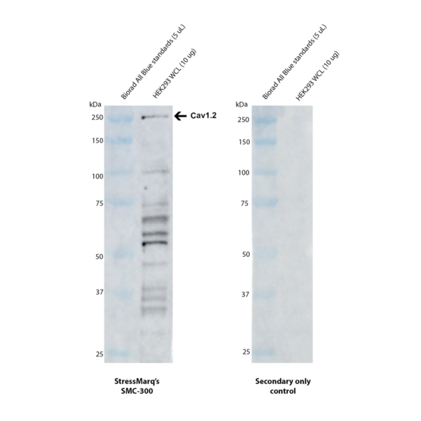 Anti-Cav1.2 Antibody - Mouse Monoclonal [S57] | StressMarq Biosciences Inc.