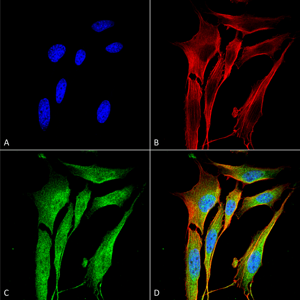 MMP9 Antibody, Clone S51-82 | Scientist.com
