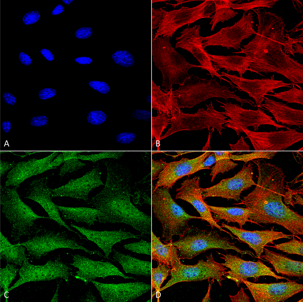 Anti-ATP7A Antibody [S60-4] Monoclonal IgG2b