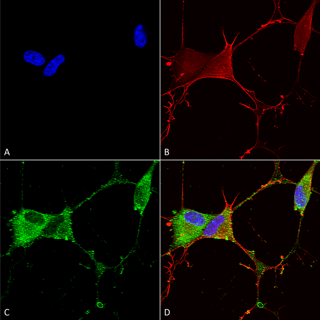 Anti-GABA B Receptor 2 Antibody [S81-2] Monoclonal IgG1