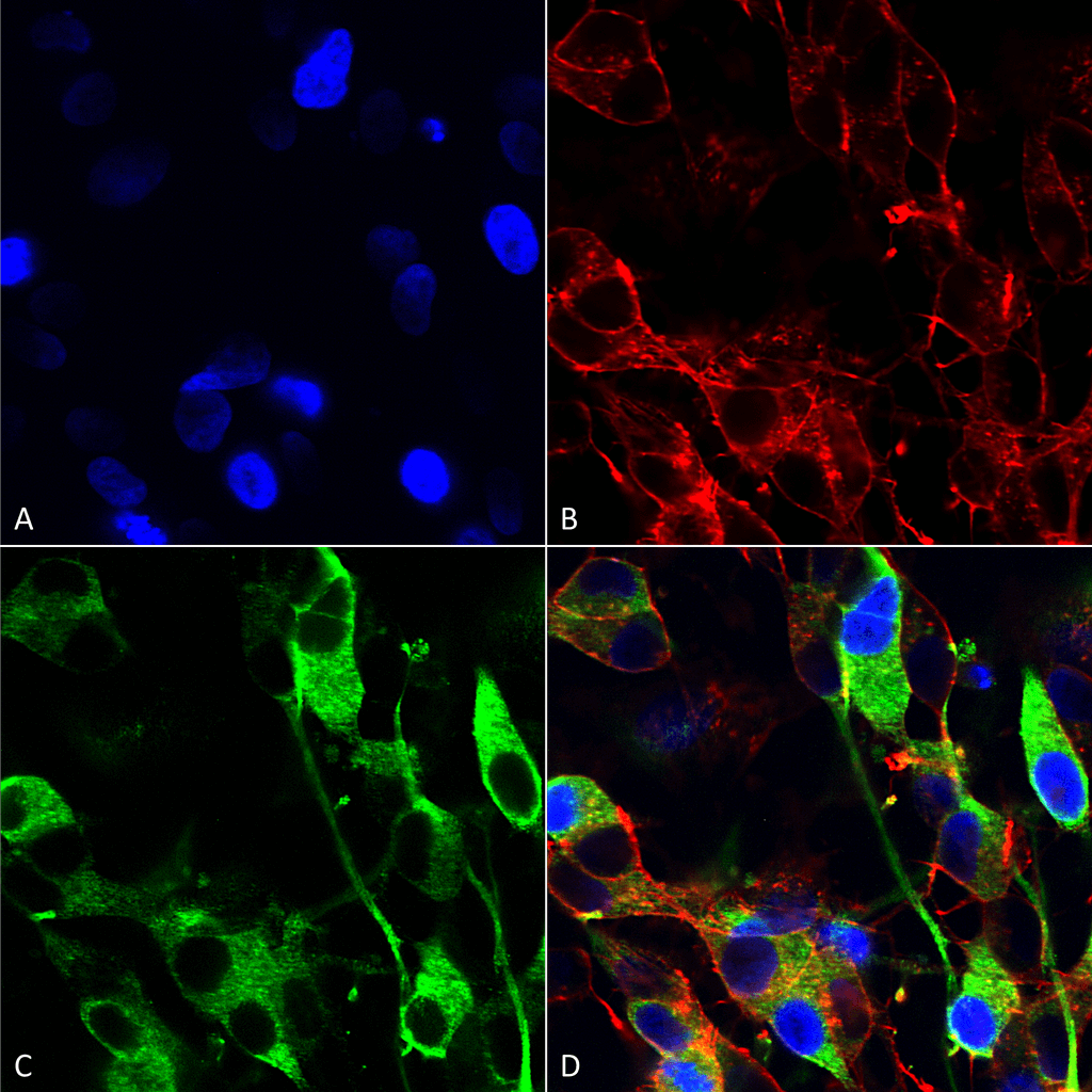 Anti-Versican Antibody [S351-23] Monoclonal IgG1