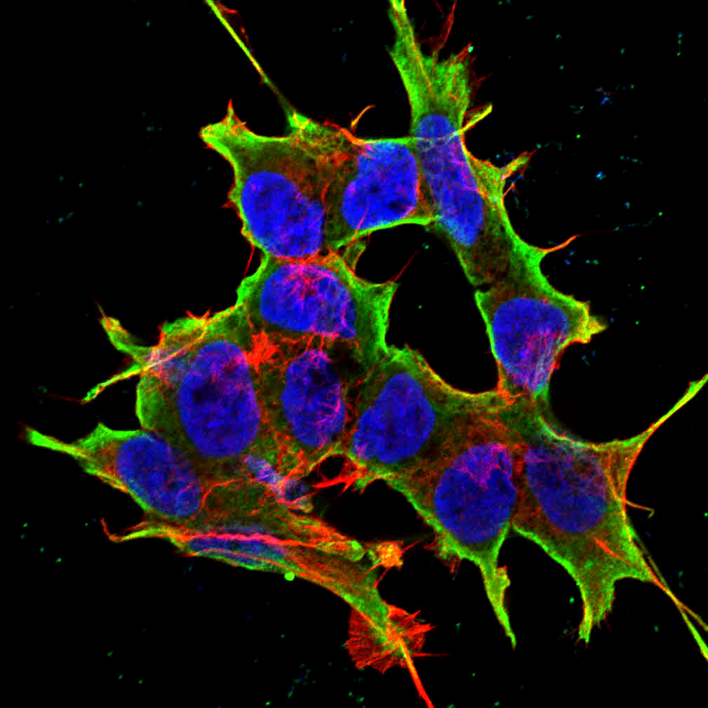 Immunocytochemistry Troubleshooting - Protocol Help | StressMarq