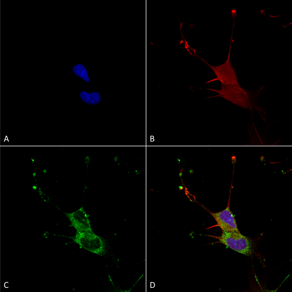 Anti-LGI1 Antibody [S283-7] Monoclonal IgG2a