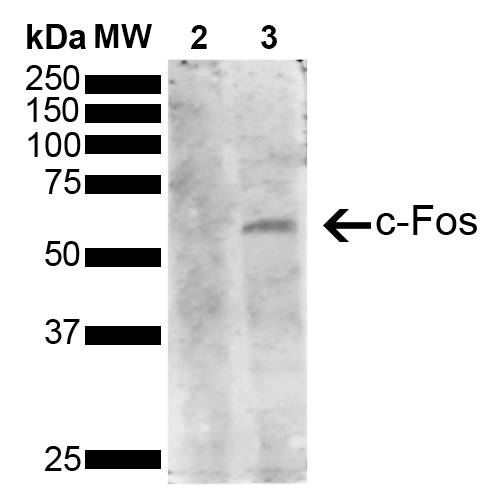 Fos Proto-Oncogene, AP-1 Transcription Factor Subunit Antibodies ...