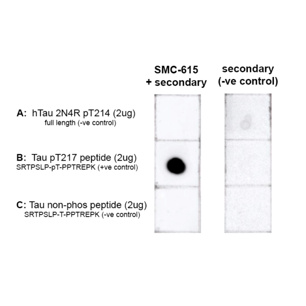 Anti-Tau Antibody (pThr217) - Mouse Monoclonal [15B7] | StressMarq ...