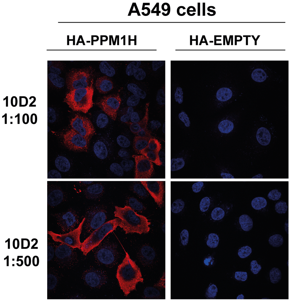 Anti-PPM1H [10D2] Mouse Monoclonal