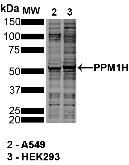 Anti-PPM1H [10D2] Mouse Monoclonal