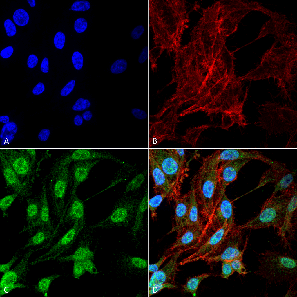 Anti-NRF2 Antibody (SPC-711) Rabbit Polyclonal | StressMarq Biosciences ...