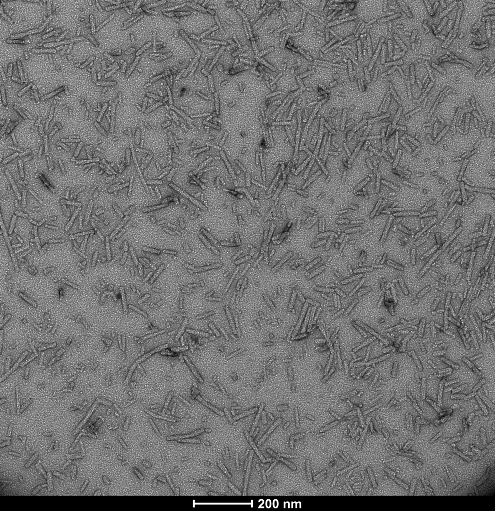 Gut Alpha Synuclein Aggregation in Parkinson’s Disease