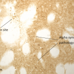 Alpha Synuclein Monomers, Oligomers & Pre-formed Fibrils