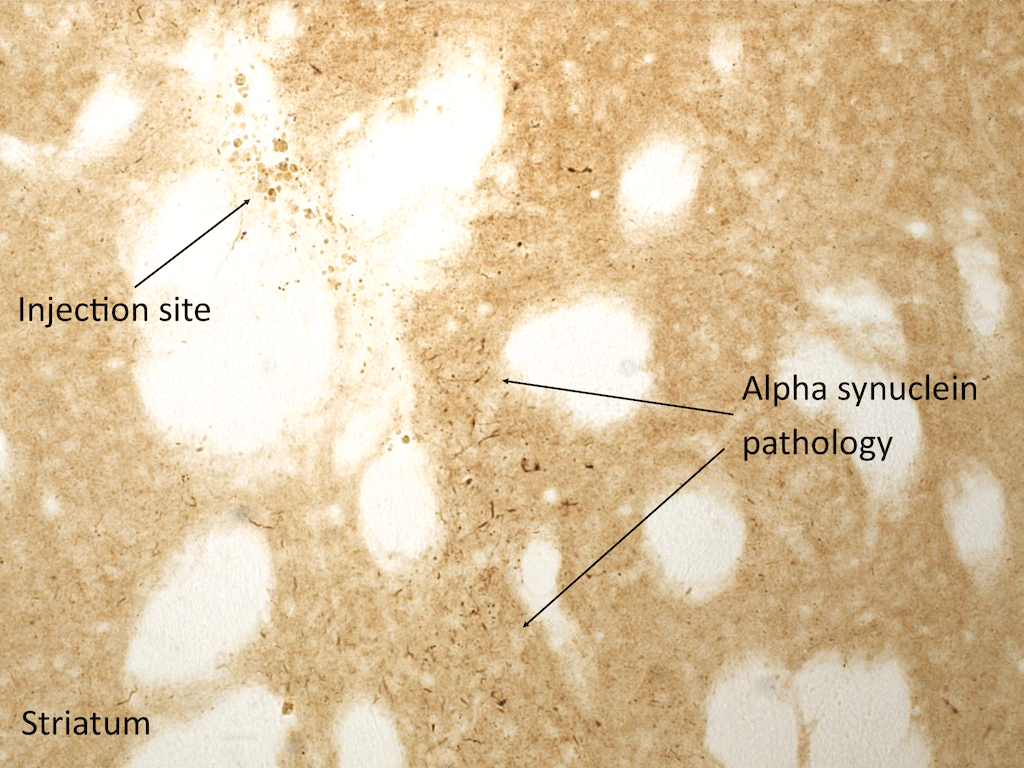 Alpha Synuclein Pre-formed Fibrils (Type 1) - 2BScientific