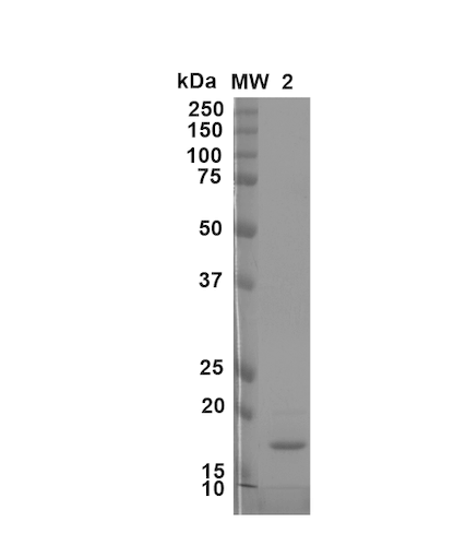 Beta Synuclein Preformed Fibrils (PFFs) | StressMarq