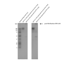 Human Tau-441 (2N4R) P301S Mutant PFFs (SPR-516) | StressMarq ...