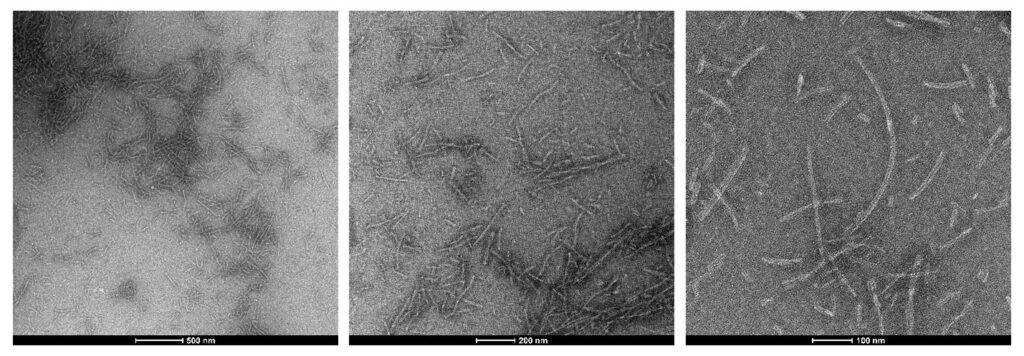 Unraveling the Complexity of Tau Protein Isoforms