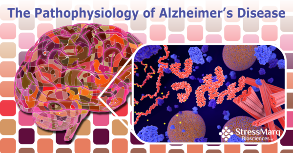Alzheimer's Disease Pathophysiology Schematic Diagram Pathop