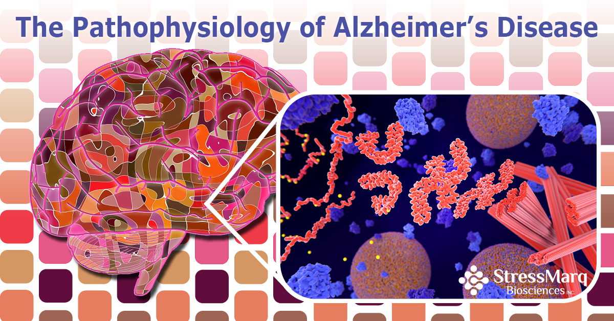 The Pathophysiology of Alzheimer's Disease | StressMarq The Pathophysiology of Alzheimer's Disease | StressMarq